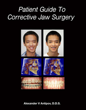 Corrective Jaw Surgery - Dr. Antipov