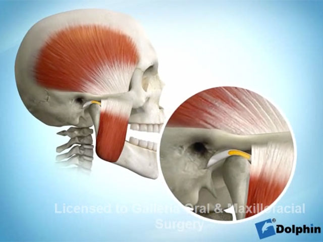 Procedure Videos - Dr. Antipov